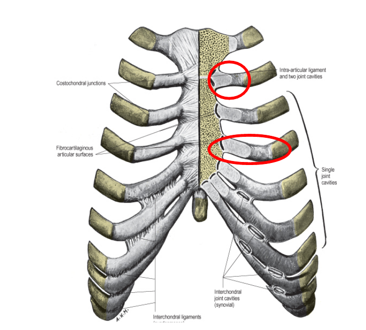 Costochondritis As A Cause Of Undiagnosed Chest Pain Costochondritis As A Cause Of Undiagnosed Chest Pain